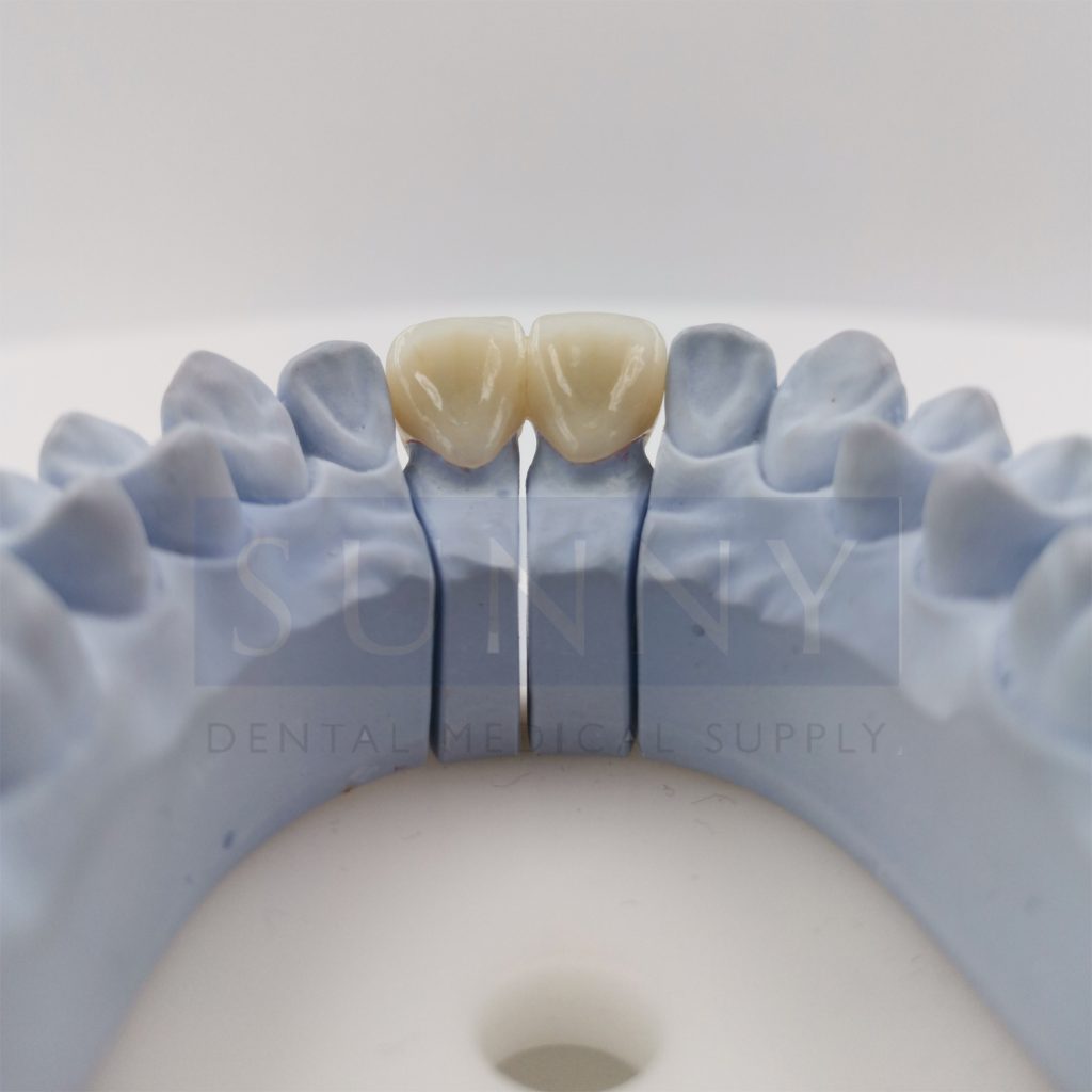 IPS Emax - Sunny Dental Medical Supply