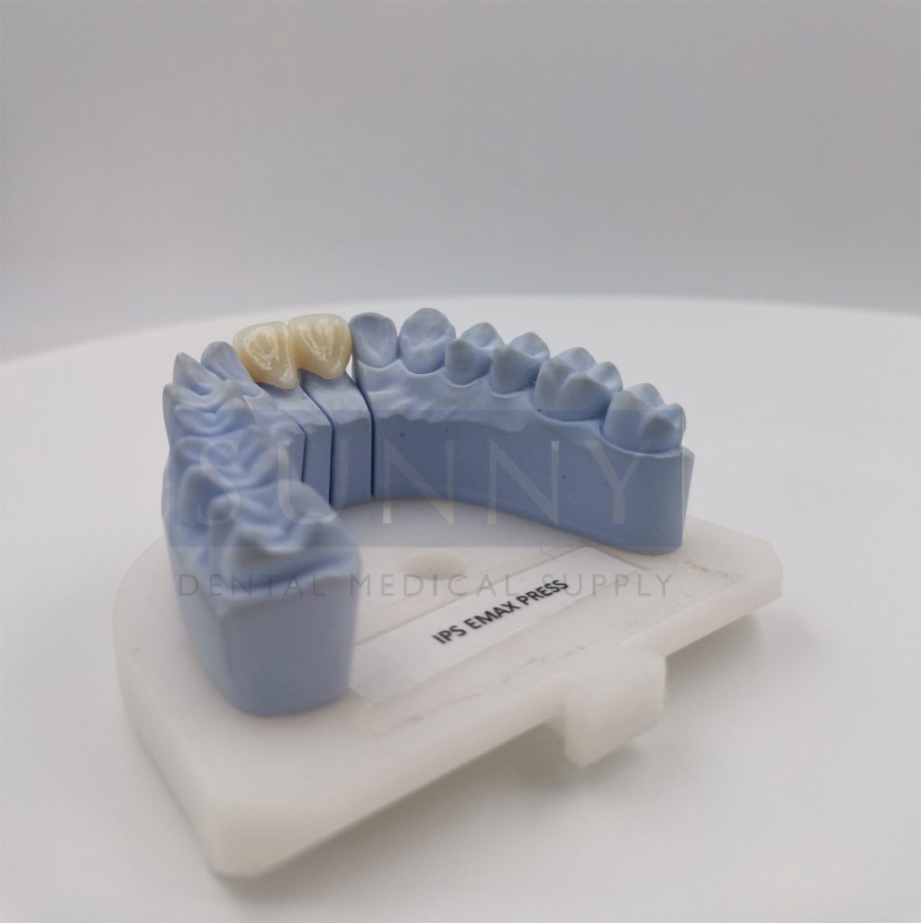 IPS Emax - Sunny Dental Medical Supply