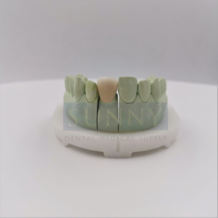 PFM (Porcelain-Fused-To-Metal) - Sunny Dental Medical Supply